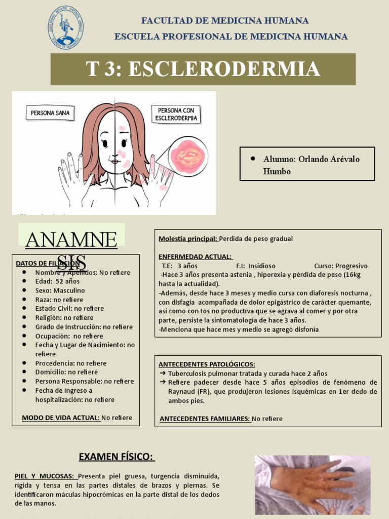 Diagnóstico y Tratamiento de Esclerodermia | PDF | Capilar ...
