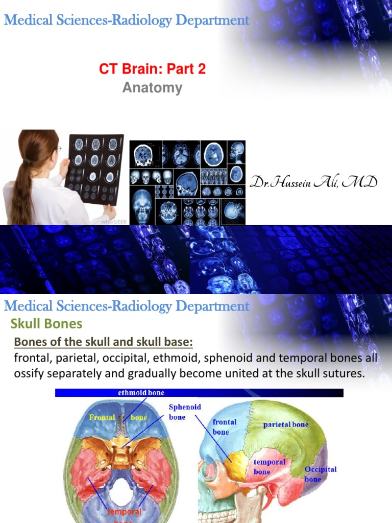 CT Brain Anatomy and Structures Overview | PDF | Skull | Cerebral Cortex