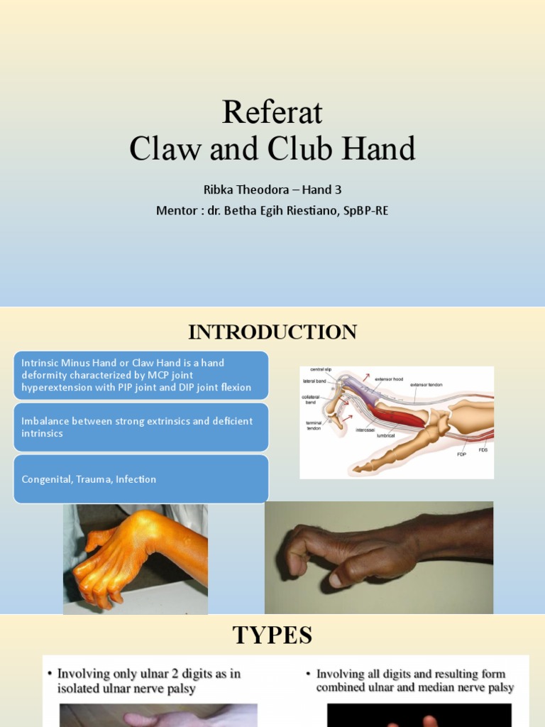 Claw Hand | PDF | Finger | Hand