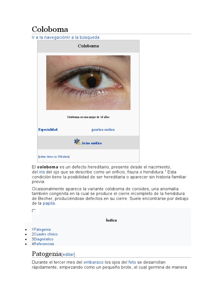 Coloboma: Defecto Ocular Congénito | PDF | Especialidades Medicas ...