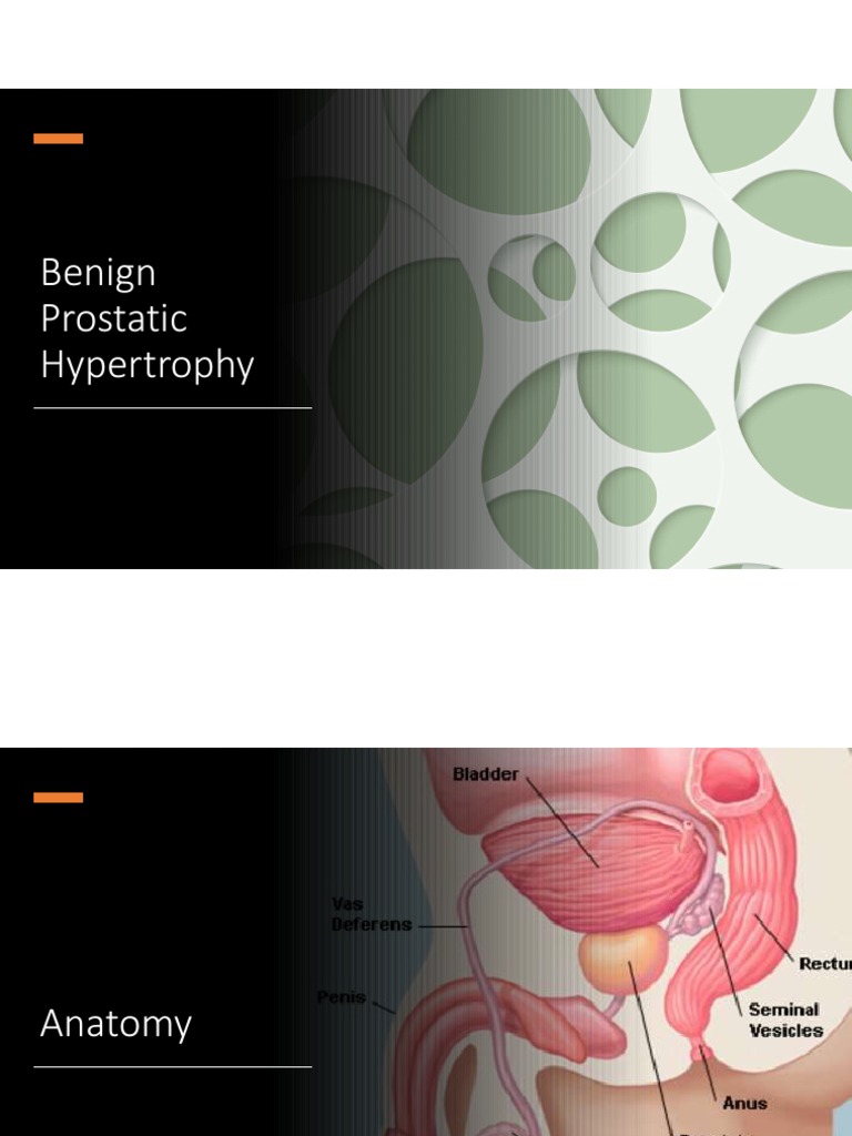 Benign Prostatic Hypertrophy | PDF | Prostate | Urinary Bladder