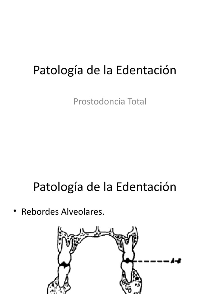 Patología de La Edentación | PDF | Hueso | Dentadura postiza