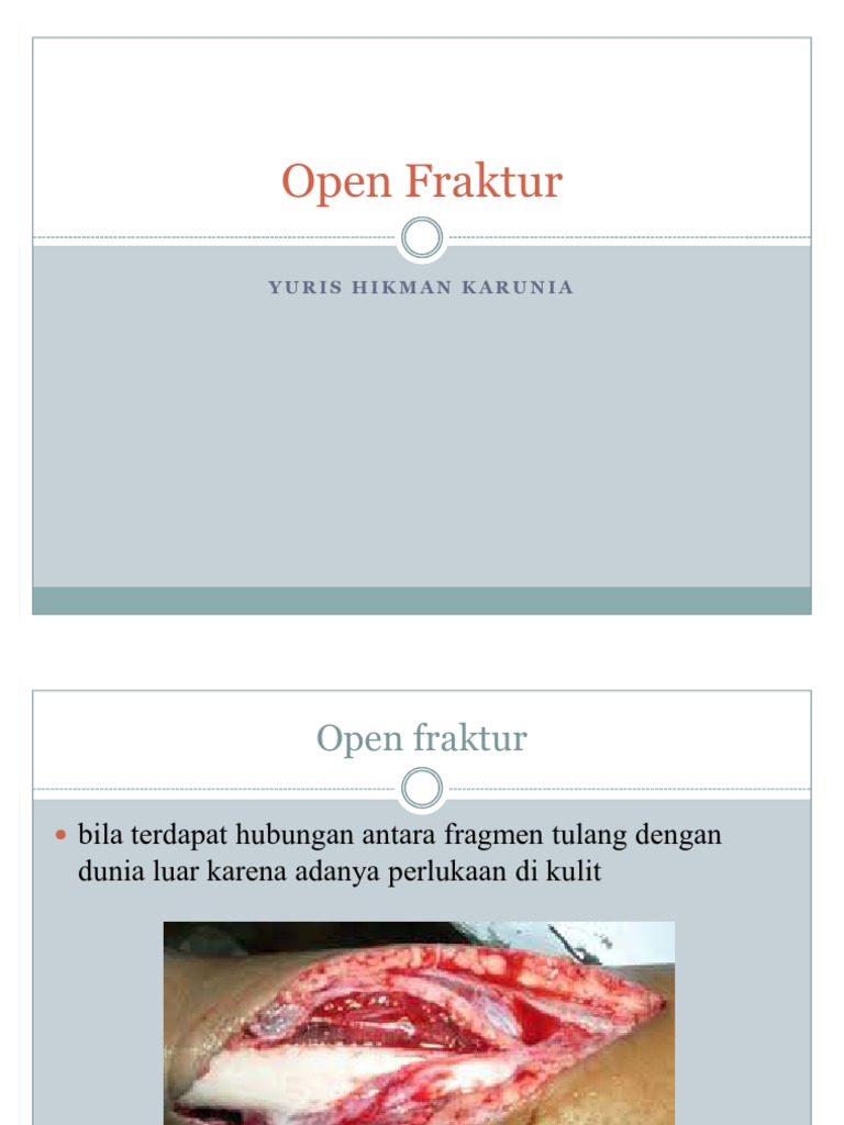 Open Fraktur | PDF