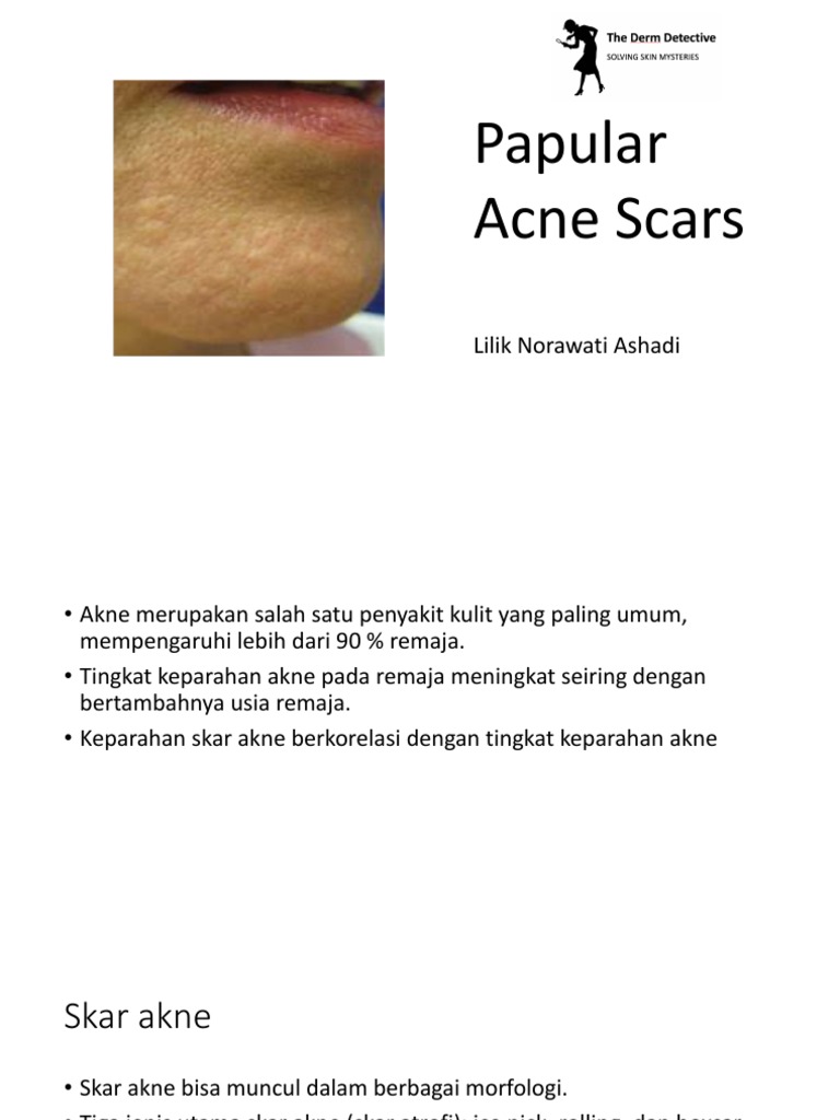 Papular Acne Scars | PDF | Sains & Matematika