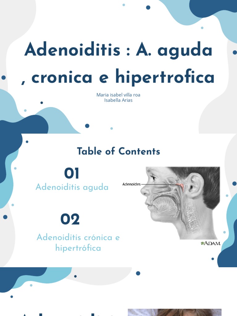 Adenoiditis - A. Aguda, Cronica e Hipertrofica | PDF | Inflamación ...