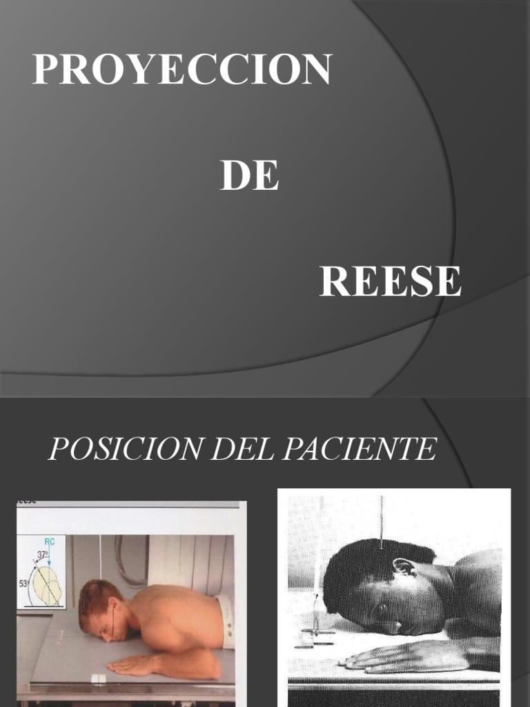 Proyeccion Reese | PDF