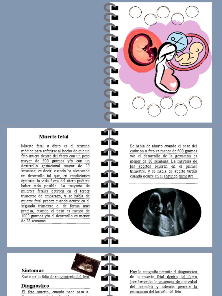 Muerte Fetal | PDF | Medicina | Salud maternal