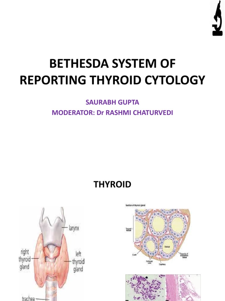 Bethesda System of Reporting Thyroid Cytology | PDF | Metastasis ...