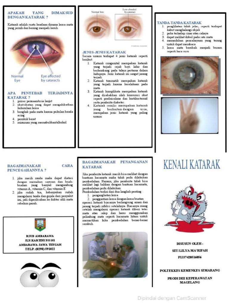 Leaflet Katarak | PDF