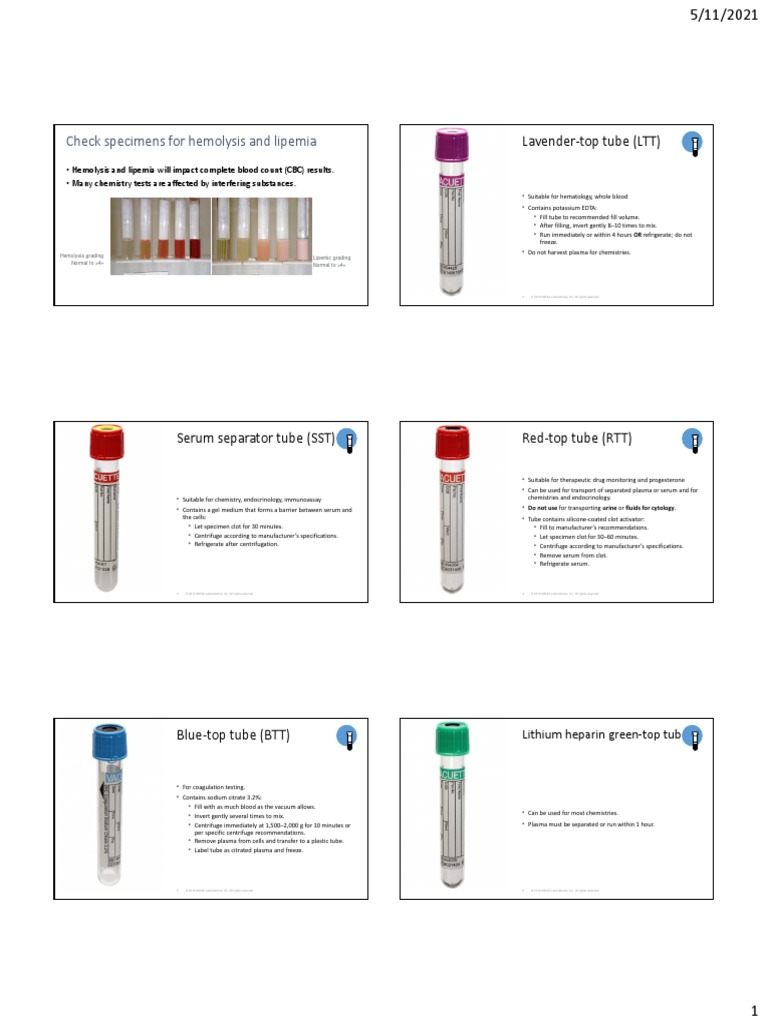 Lavender Top Tube (LTT) : Check Specimens For Hemolysis and Lipemia ...