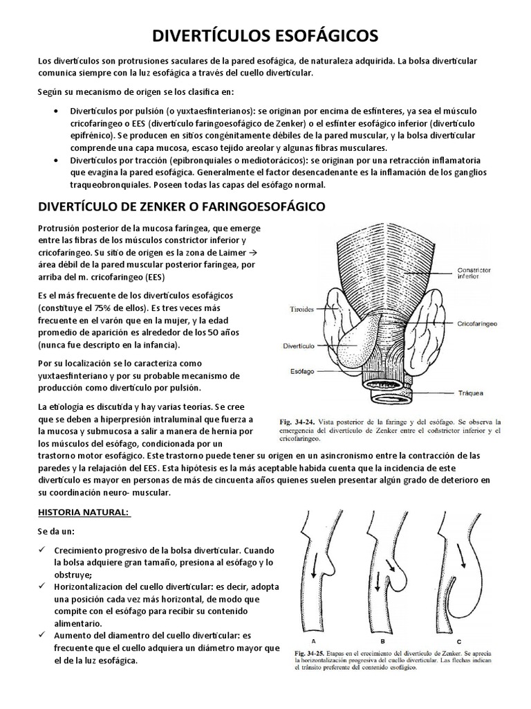 Divertículos Esofágicos | PDF | Músculo esquelético | Esófago