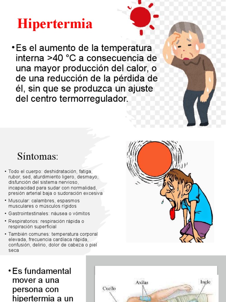 Hipertermia | PDF