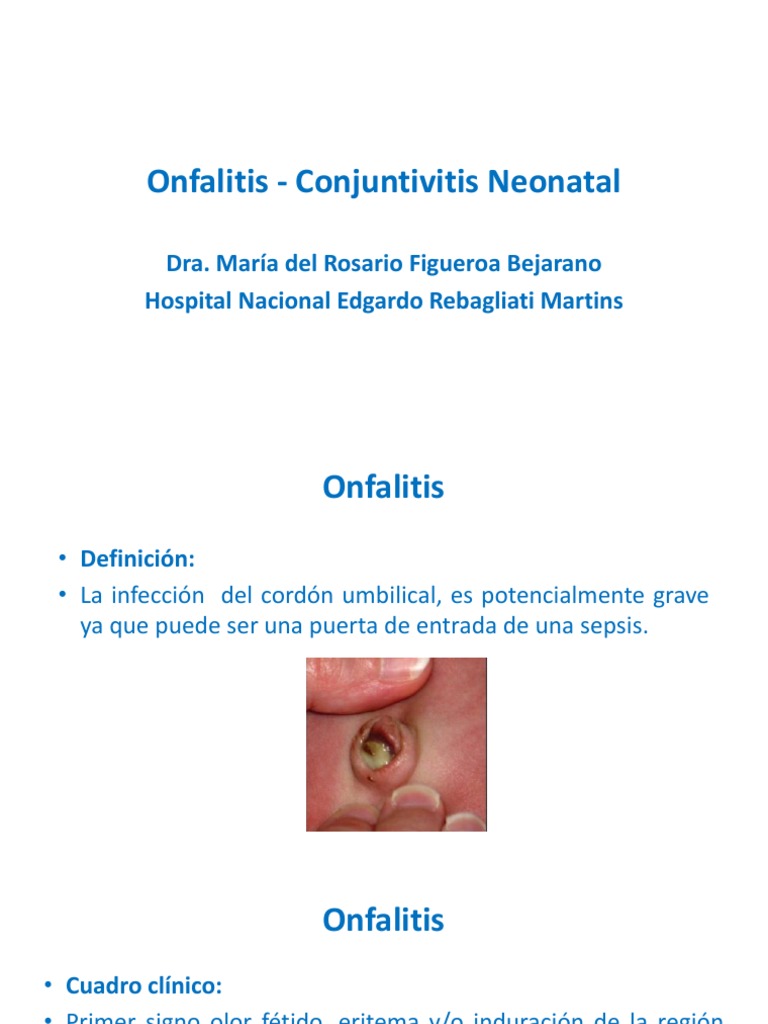 Onfalitis y Conjuntivitis Neonatal | PDF | Medicina CLINICA | Microbiología