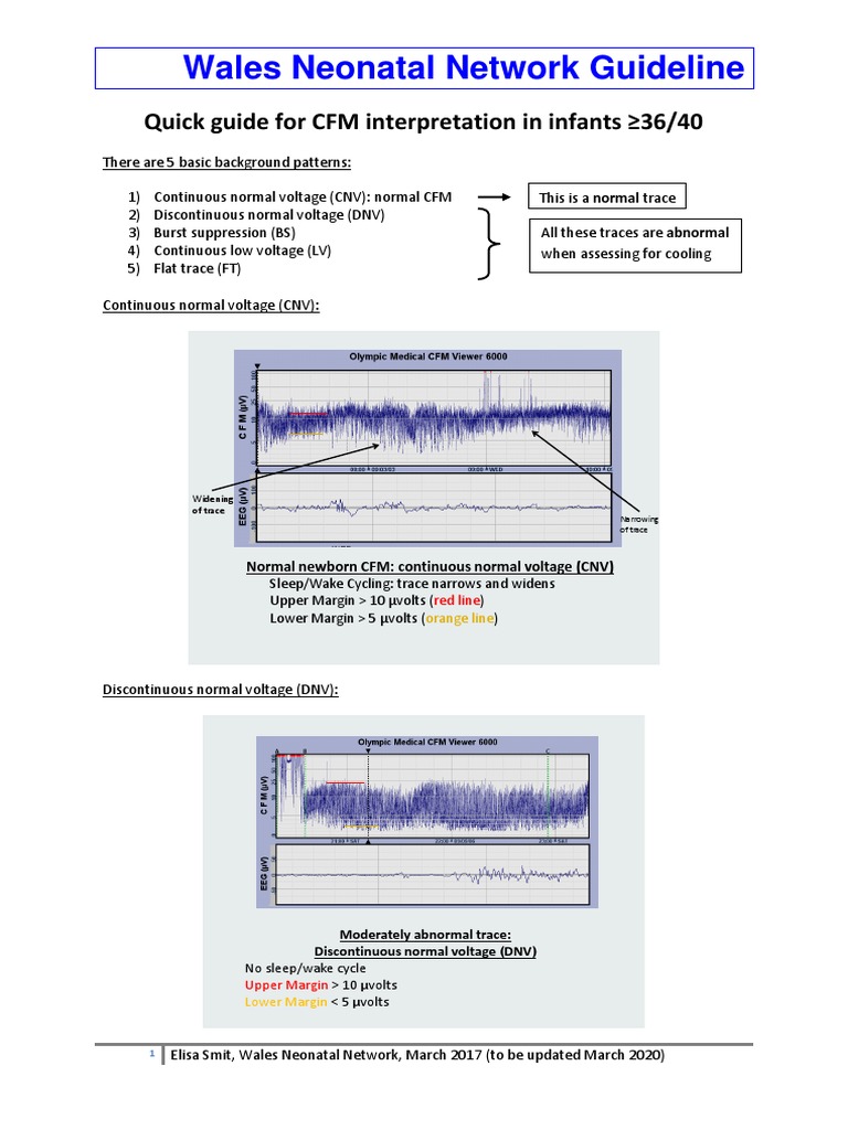 Quick Guide For CFM Pattern Recognition For Network Final | PDF ...