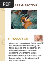 LSCS Procedure Overview and Steps | PDF | Childbirth | Caesarean Section
