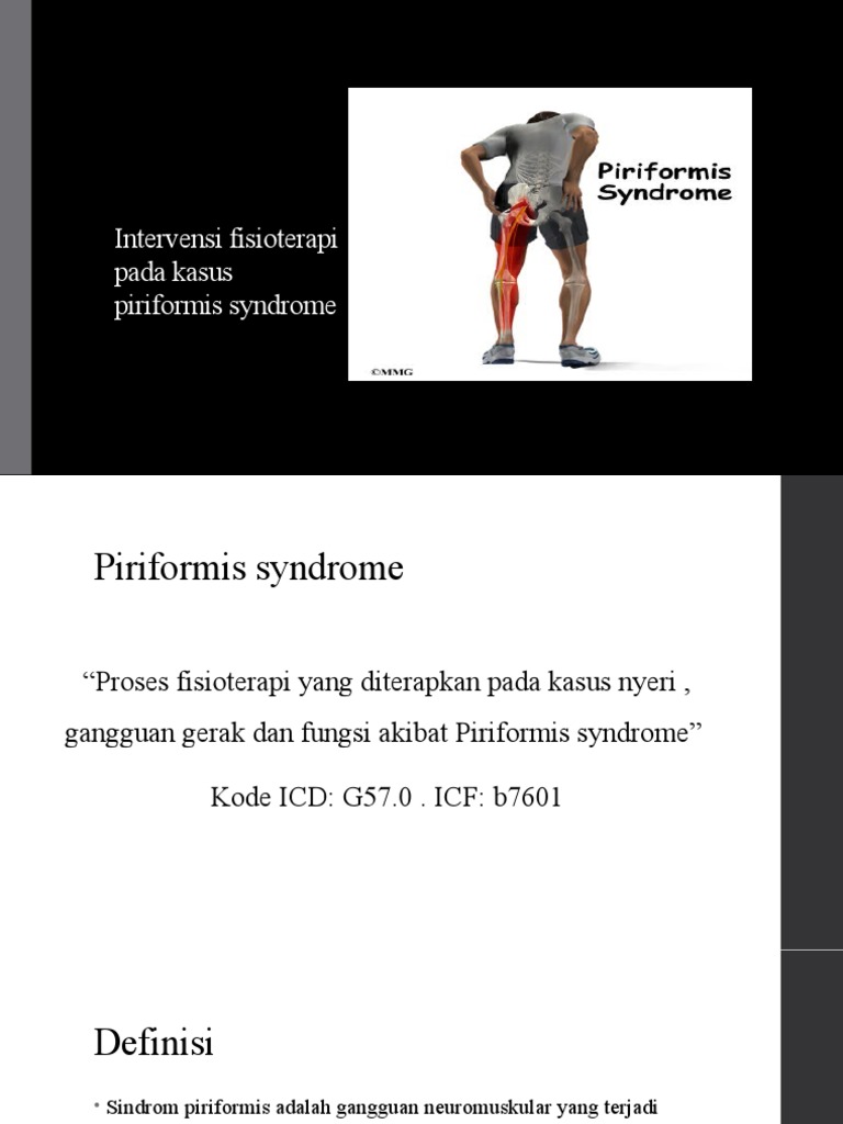 Intervensi Fisioterapi Pada Kasus Piriformis Syndrome | PDF