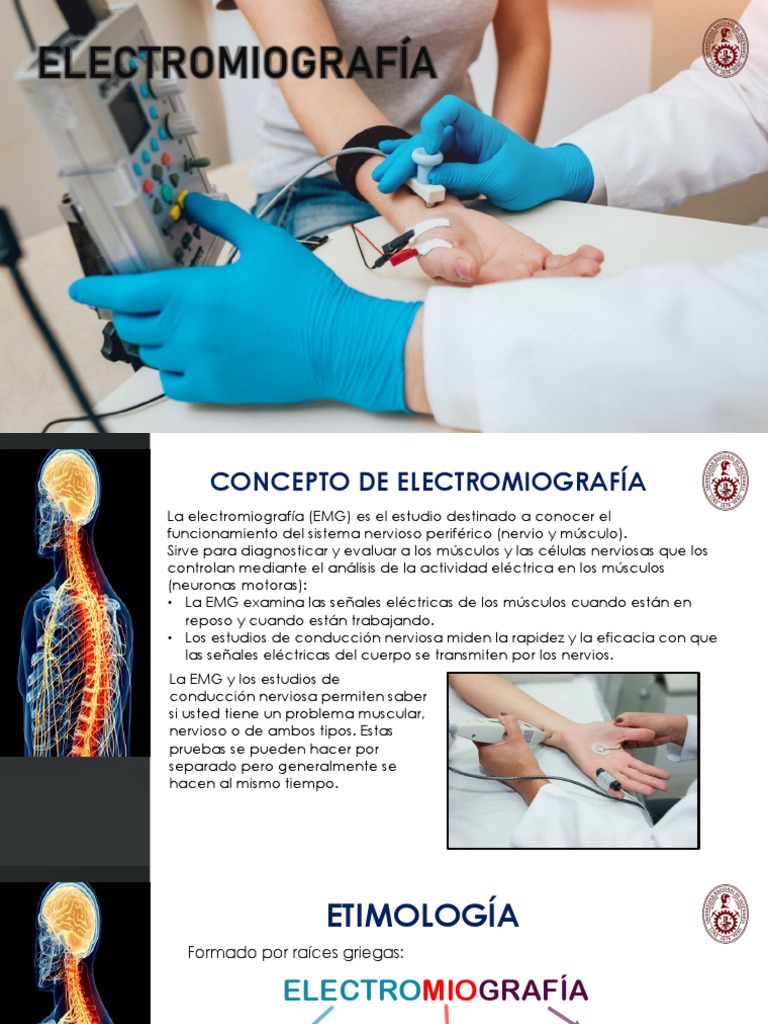 Electromiografía: Diagnóstico Muscular y Nervioso | PDF ...