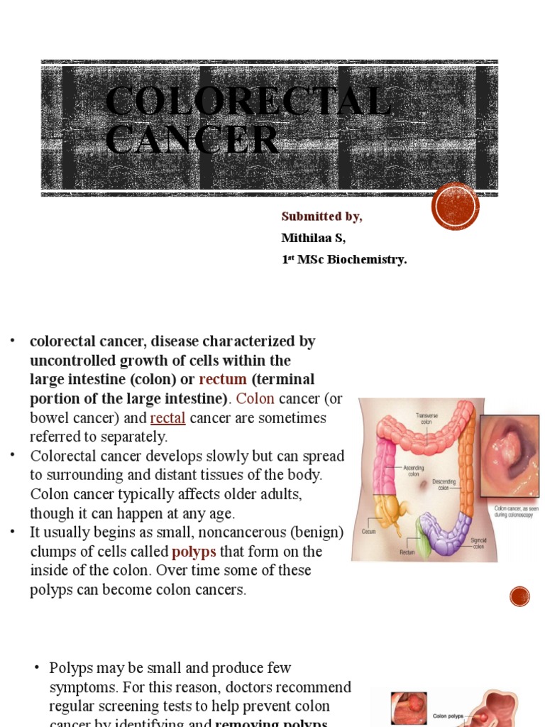 Colorectal Cancer | PDF | Colorectal Cancer | Cancer