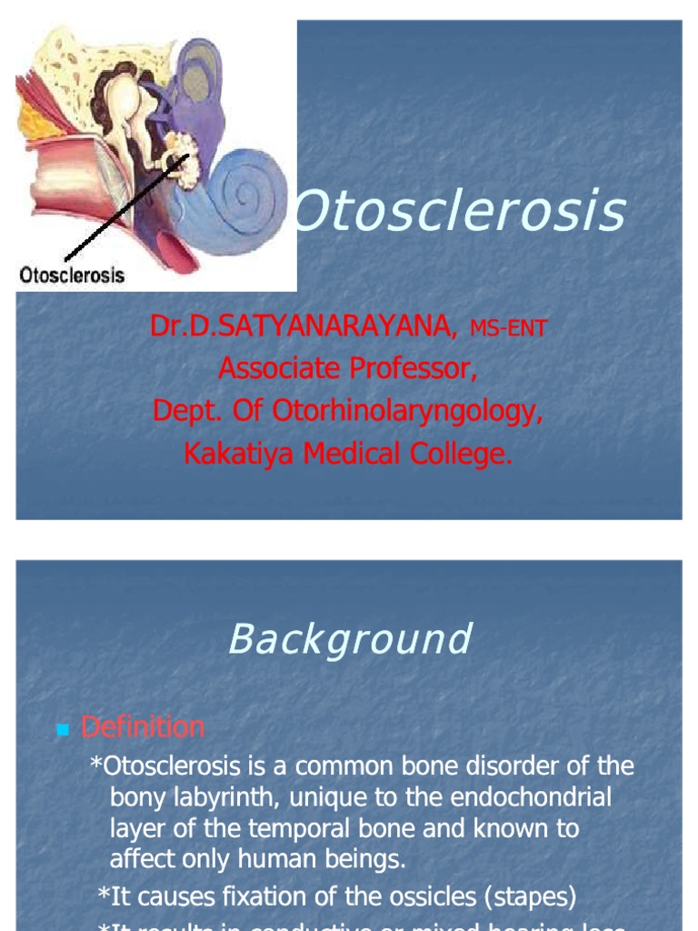 Otosclerosis | Otology | Hearing