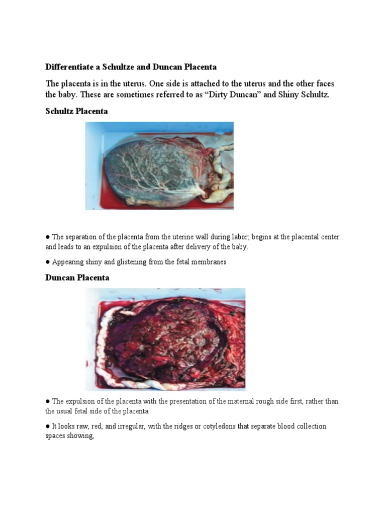 Differentiate a Schultze and Duncan Placenta | PDF | Uterus | Placenta