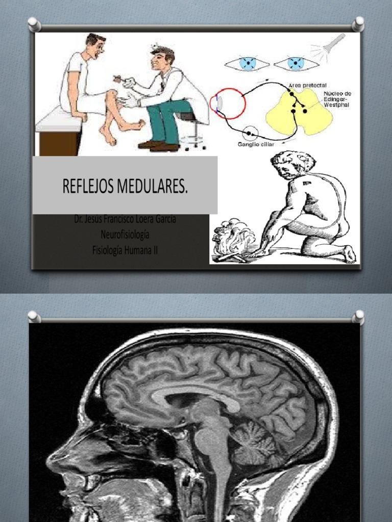Reflejos Medulares | PDF | Neurona motora | Neurona