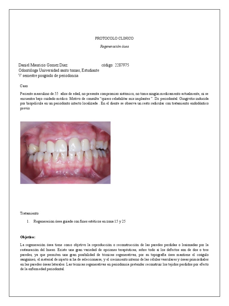 Regeneración Ósea y Defectos Intraoseos | PDF | Hueso | Medicina