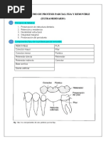 Principios PPR Apoyos, Retenedor Directo e Indirecto | PDF | Dentadura ...