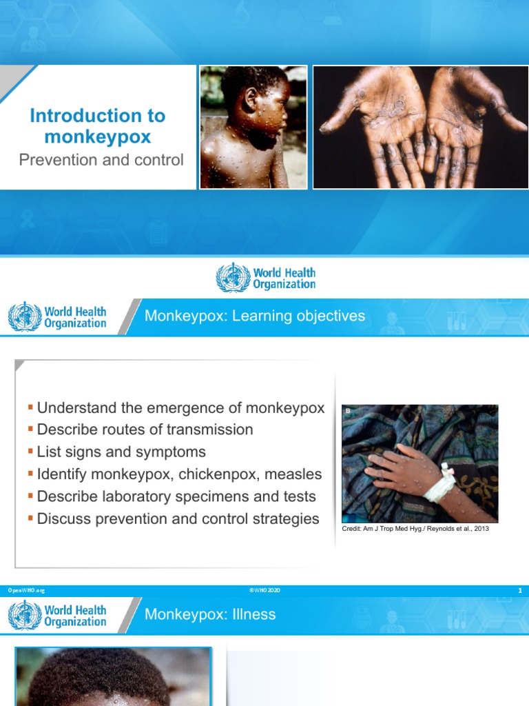 Introduction To Monkeypox: Prevention and Control | PDF | Smallpox | Medicine