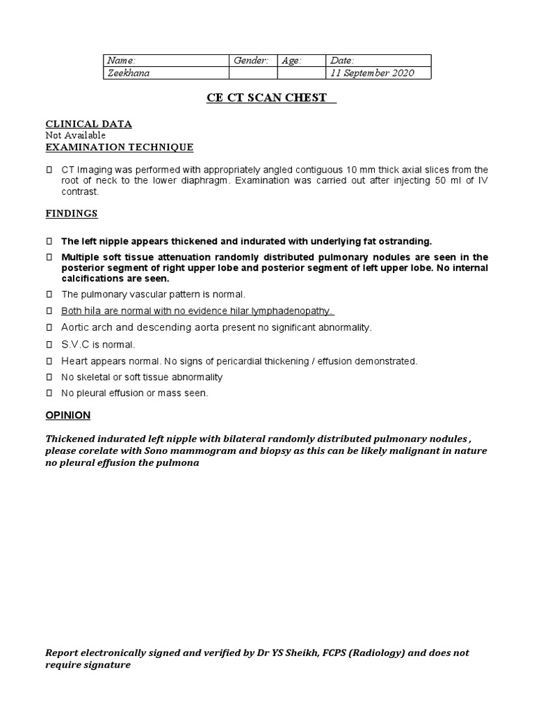 CT Chest Report Revealing Thickened Left Nipple and Bilateral Pulmonary ...