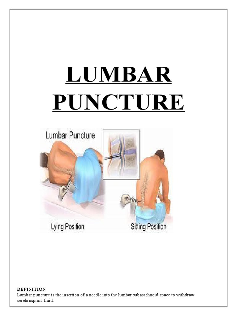 Lumbar Puncture | PDF | Cerebrospinal Fluid | Clinical Medicine