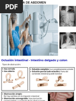 Clase Ileo Obstructivo y No Obstructivo | PDF | Intestino grueso | Abdomen