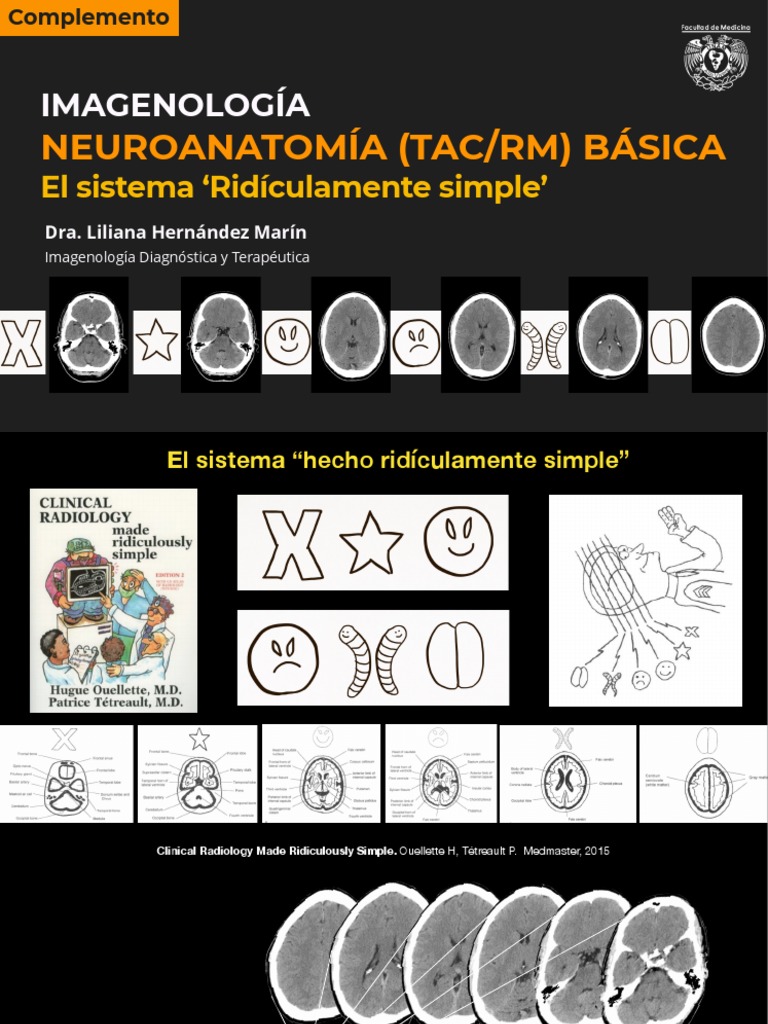 Neuroanatomía Básica PDF | PDF | Cerebro | Corteza Insular