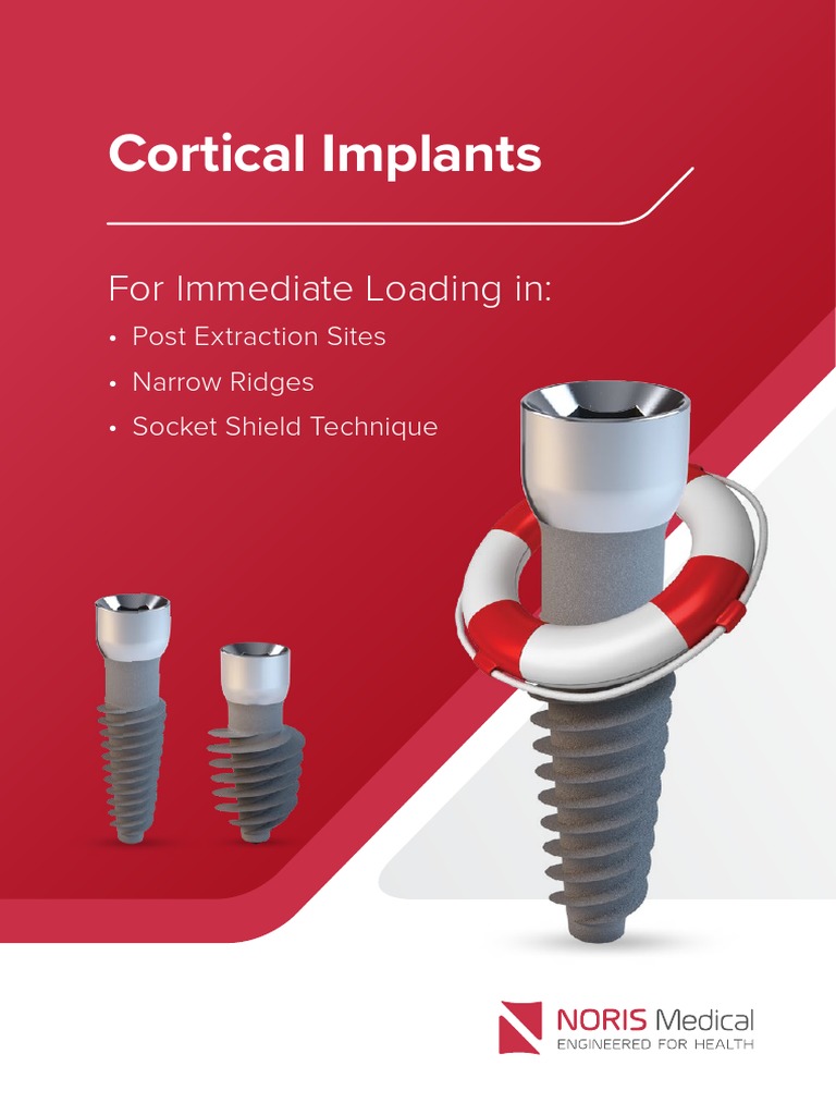 Cortical Implants: For Immediate Loading in | PDF | Dental Implant ...