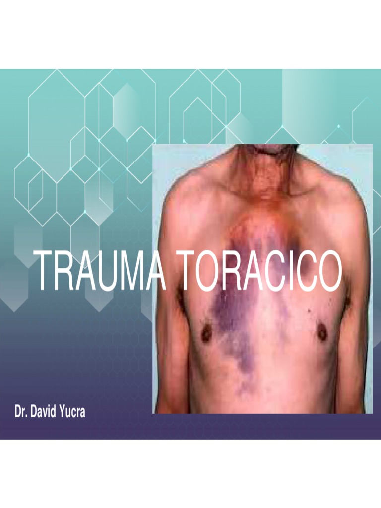 Trauma Toracico - Atls PPDF | PDF | Enfermedades y trastornos humanos ...