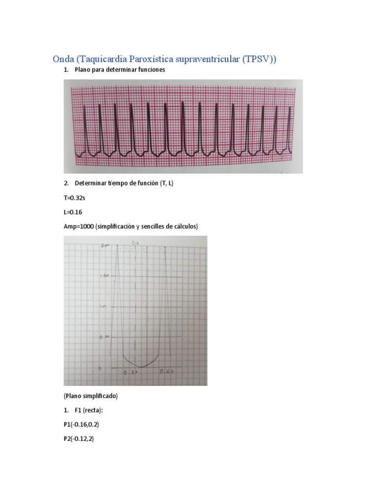 Análisis de TPSV y Series de Fourier | PDF