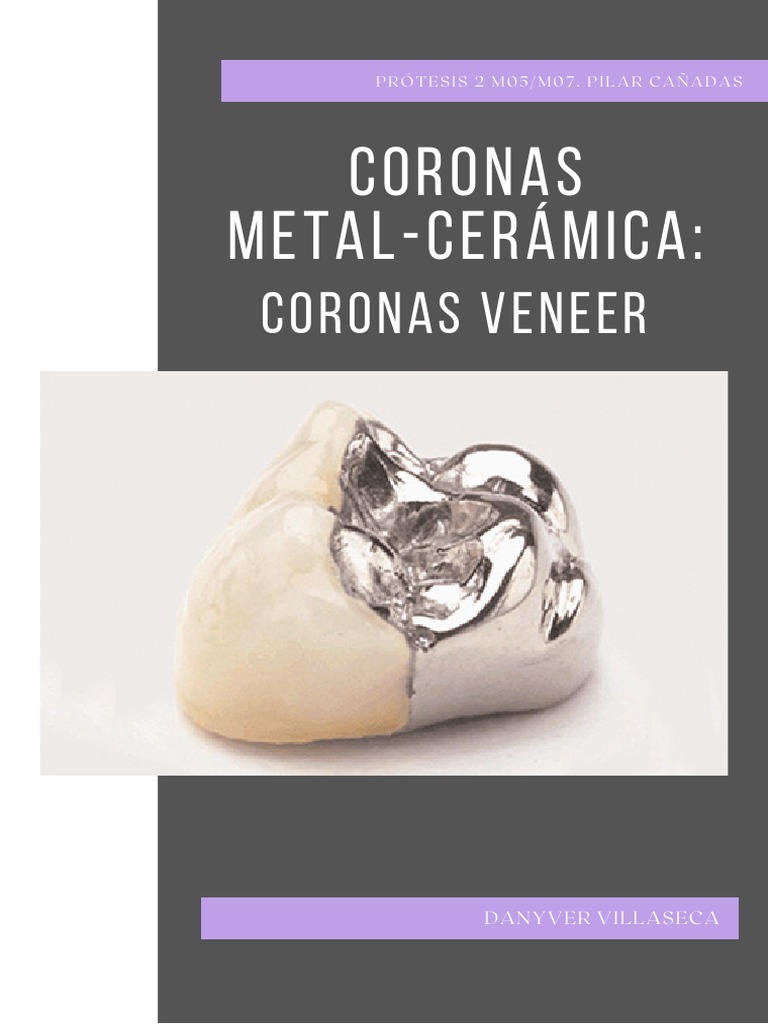 Coronas Veneer | PDF | Dentadura postiza | Cerámica