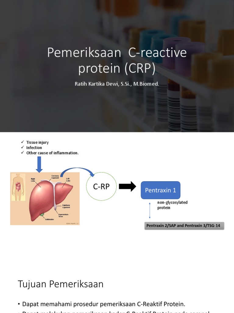 Pemeriksaan C-Reactive Protein (CRP) | PDF