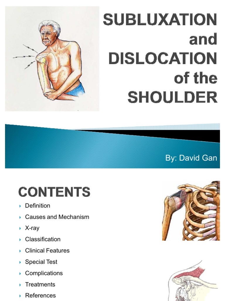 Subluxation and Dislocation of Ac Joint | PDF | Shoulder | Arm