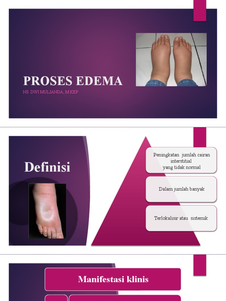 Penyebab dan Mekanisme Edema Medis | PDF