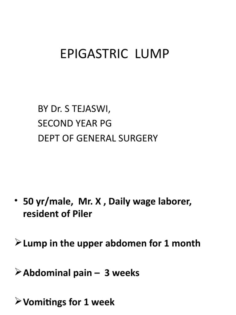 Epigastric Lump: by Dr. S Tejaswi, Second Year PG Dept of General ...
