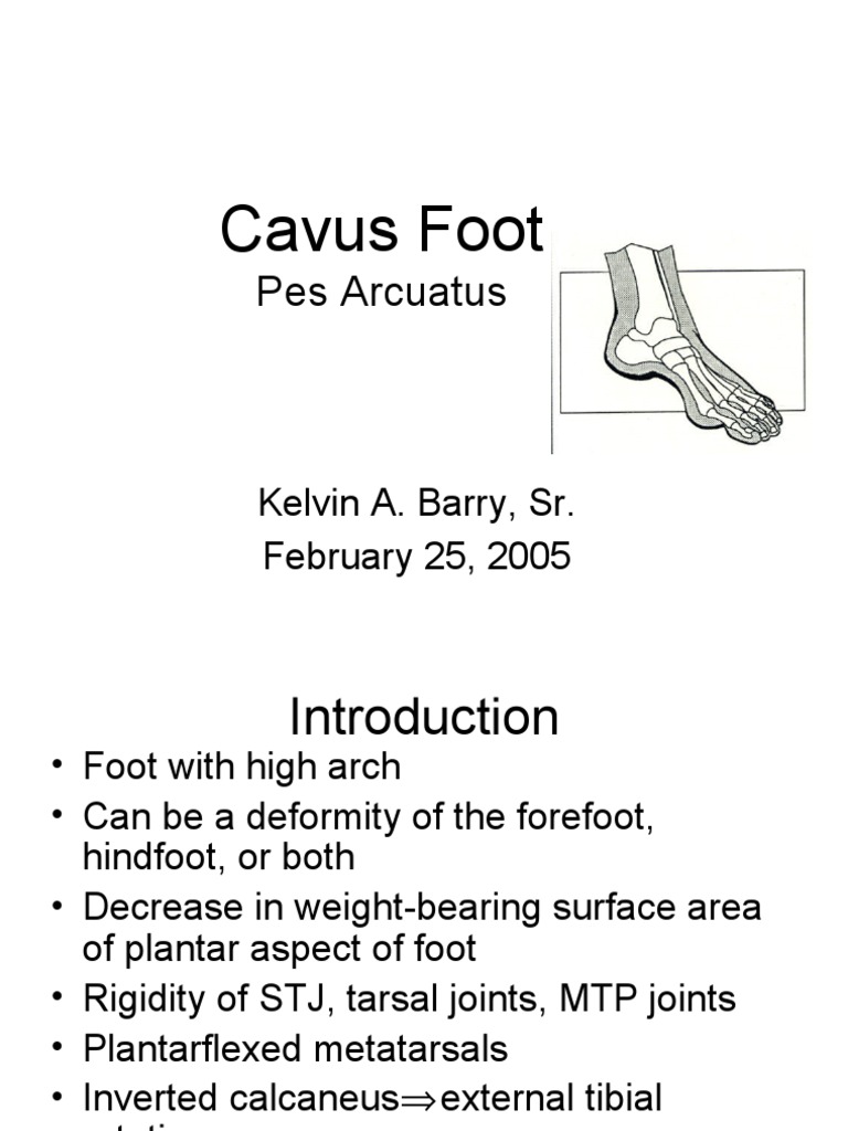 Cavus Foot | PDF | Foot | Musculoskeletal System