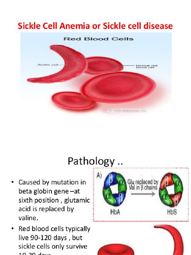 L 13 Cell Sickle Test Hematology Practice DR GR | PDF | Wellness ...