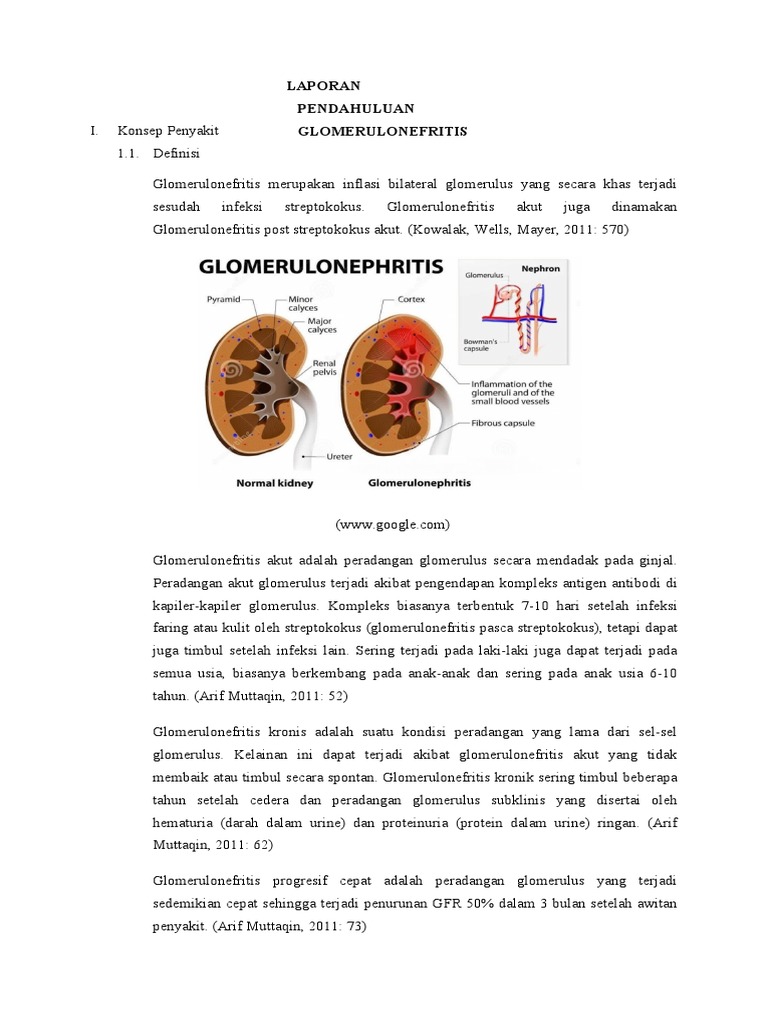 LP Glomerulonefritis | PDF