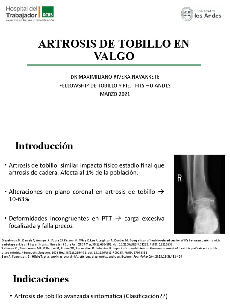 Artrosis de Tobillo en Valgo | PDF | Desordenes metabólicos | Epidemiología