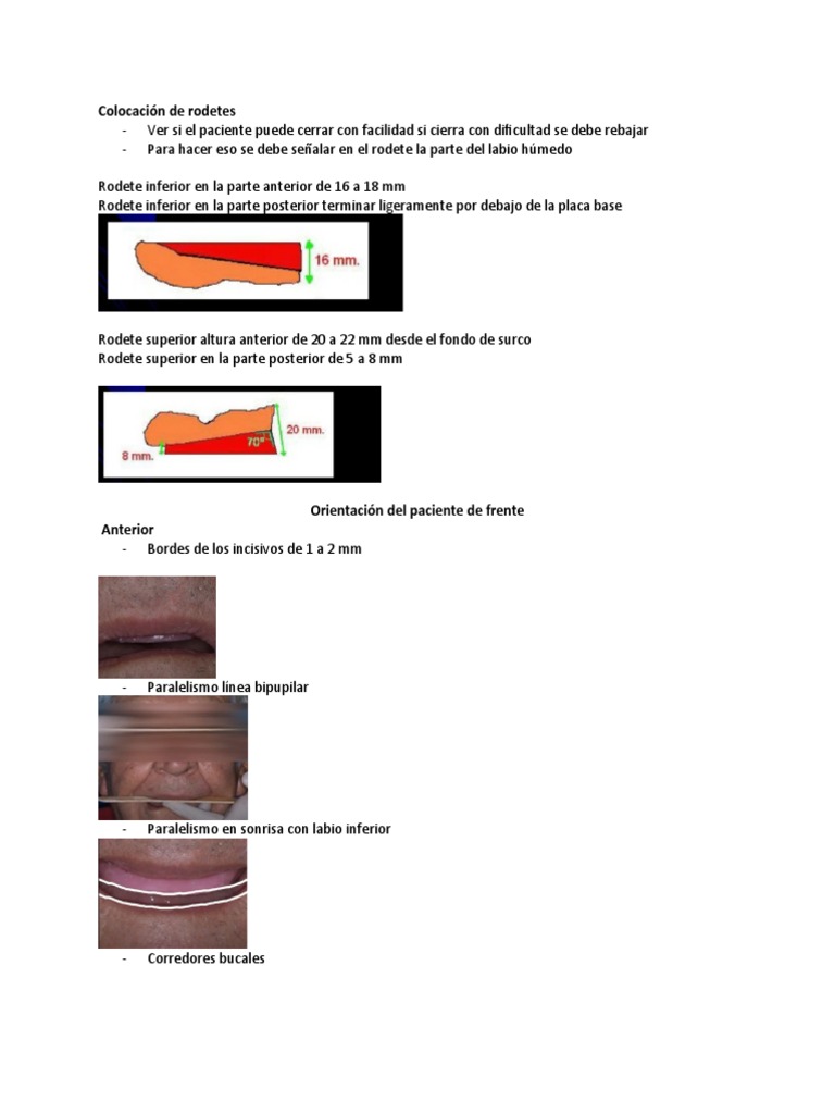Colocación de Rodetes | PDF