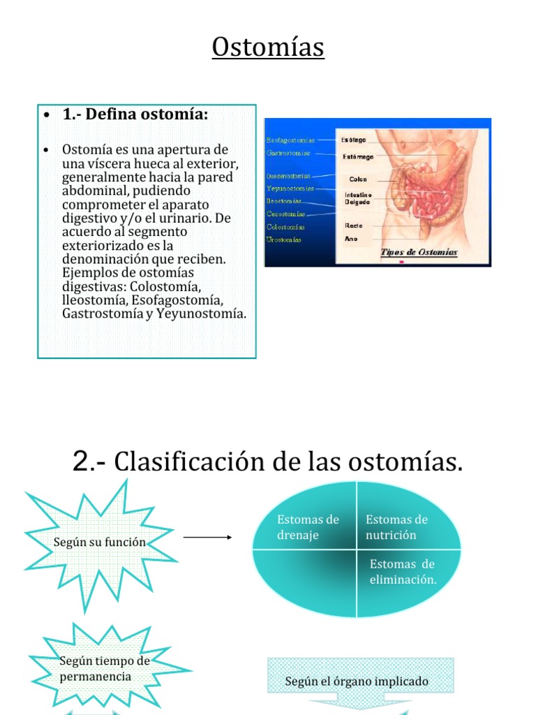 Ostomías