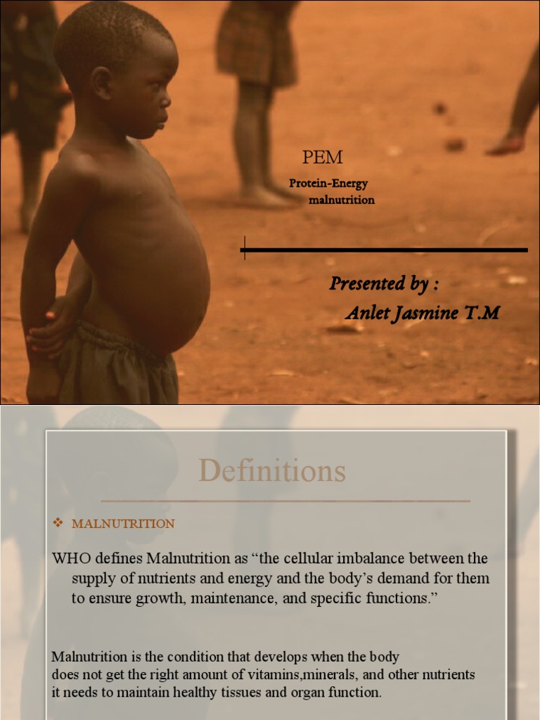 Presented By: Anlet Jasmine T.M: Protein-Energy Malnutrition | PDF ...