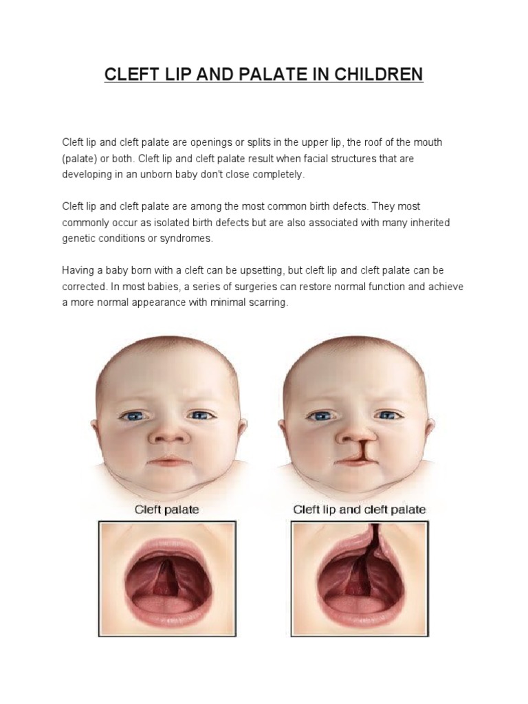 Cleft Palate and Lips | PDF | Medical Specialties | Diseases And Disorders