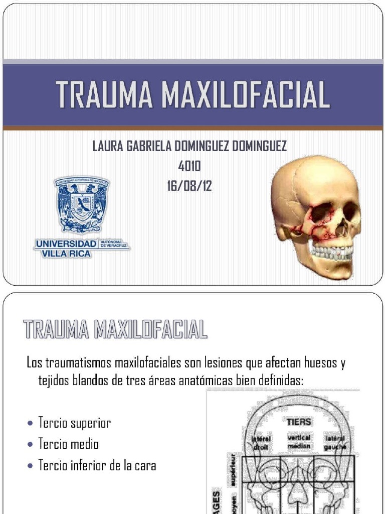 Trauma Maxilofacial | PDF