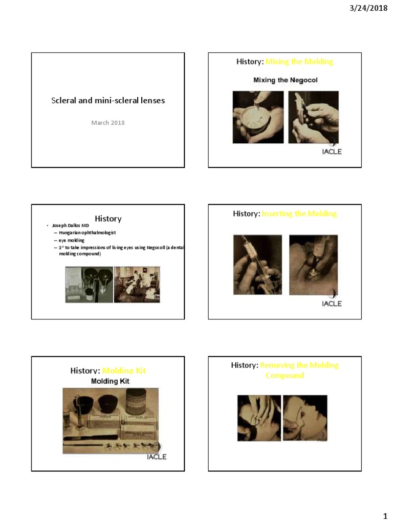 Mini Scleral Lens Fitting Guide | PDF | Cornea | Eye